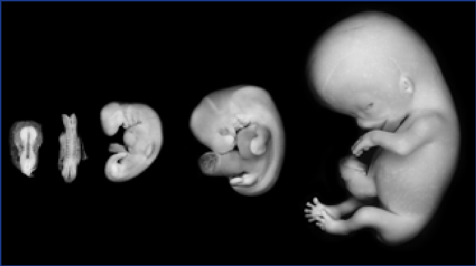 Embryo adoption - Meaning, advantages and disadvantages | IVF India